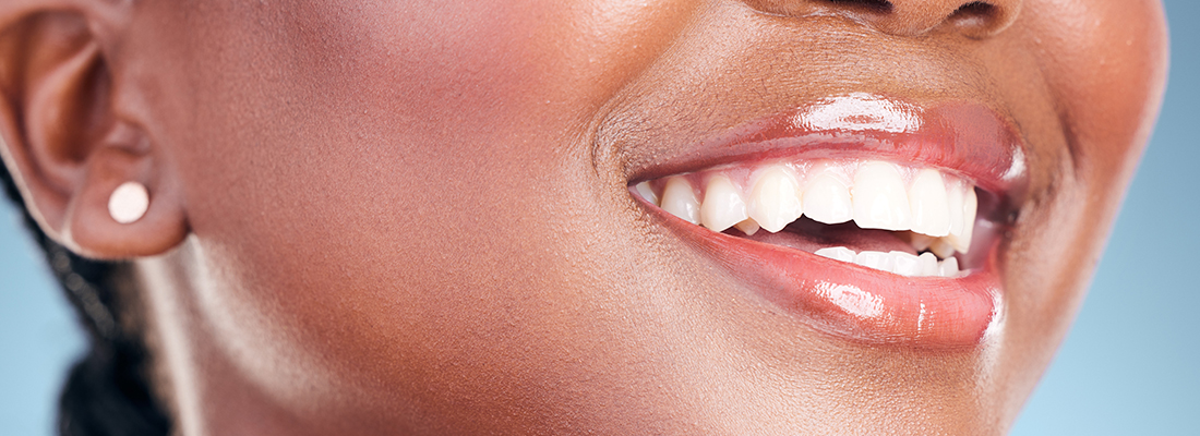Teeth Whitening | Dental Hub